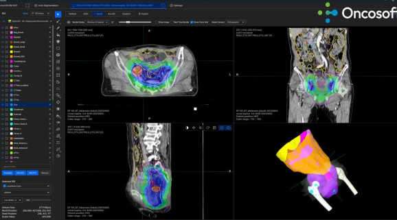 Qt그룹, 의료 AI 시장 공략 강화... 온코소프트에 'OncoStudio 2.0' 고도화 지원